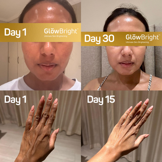 Extreme Skin Brightening Drink – Glow Bright