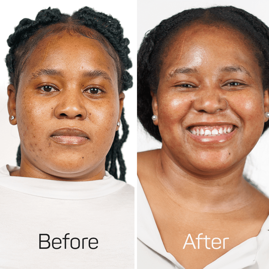 Results – Glow Bright